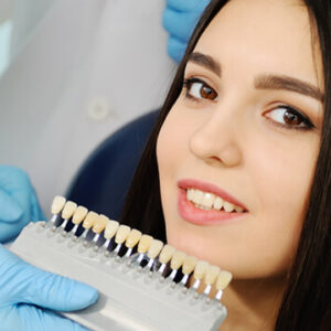 Do Veneers Last Forever? The Low-Down on the Lifespan of Veneers