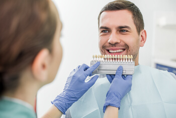 Teeth Prepared for Veneers — A Comprehensive Guide For You