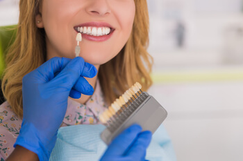 Shaved Teeth For Veneers? A Detailed Guide For The Process
