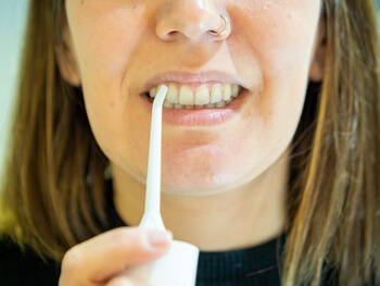 Before and After Water Flosser — The Miracle of Water Flossing