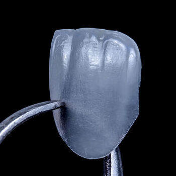 What Happens When You Get Veneers? | Beyond Infinity Dental