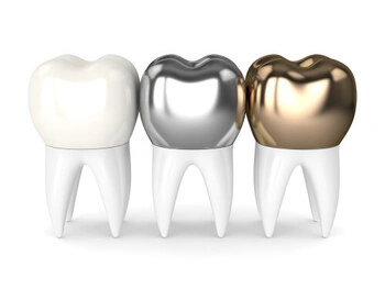 Symptoms of Loose Dental Implant Crown: What to Know